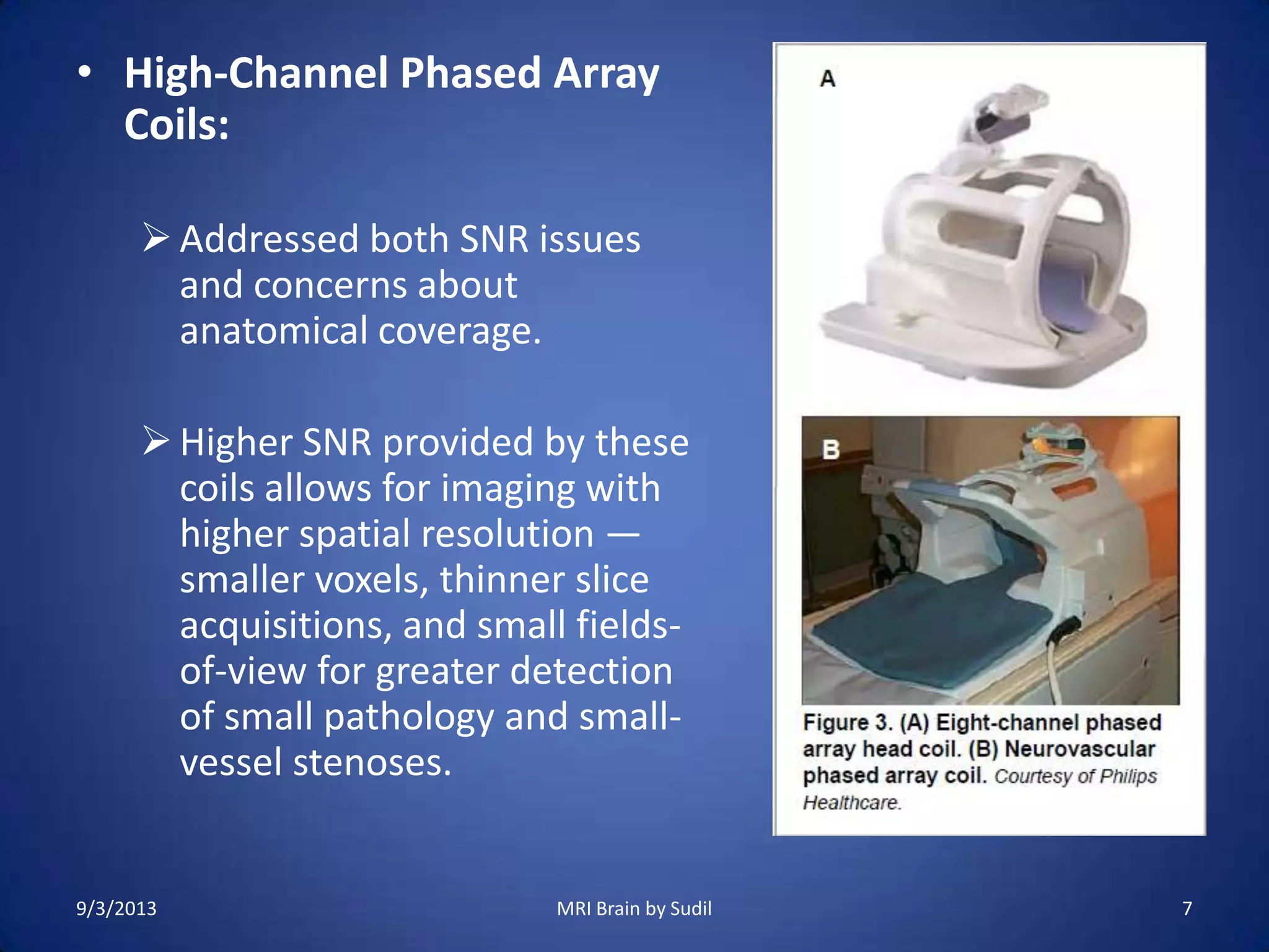 MRI Procedure of Brain | PPTX