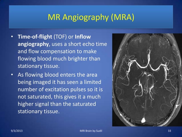 MRI Procedure of Brain | PPTX