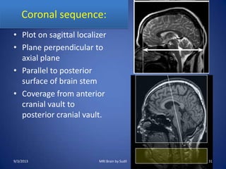 Frontal Plane Mri