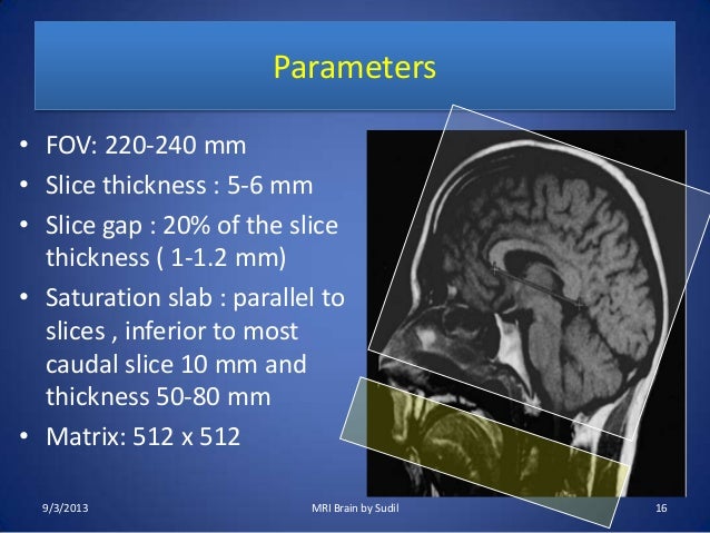 MRI Procedure of Brain