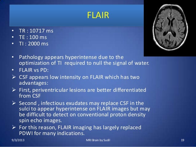 MRI Procedure of Brain