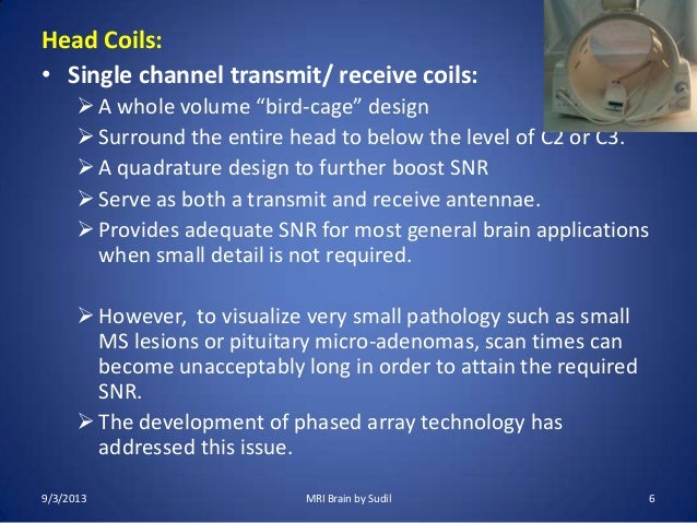 MRI Procedure of Brain