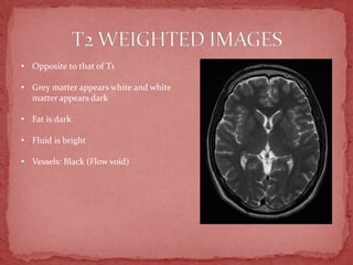 MRI Brain | PPTX