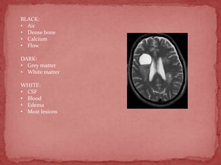 MRI Brain | PPTX