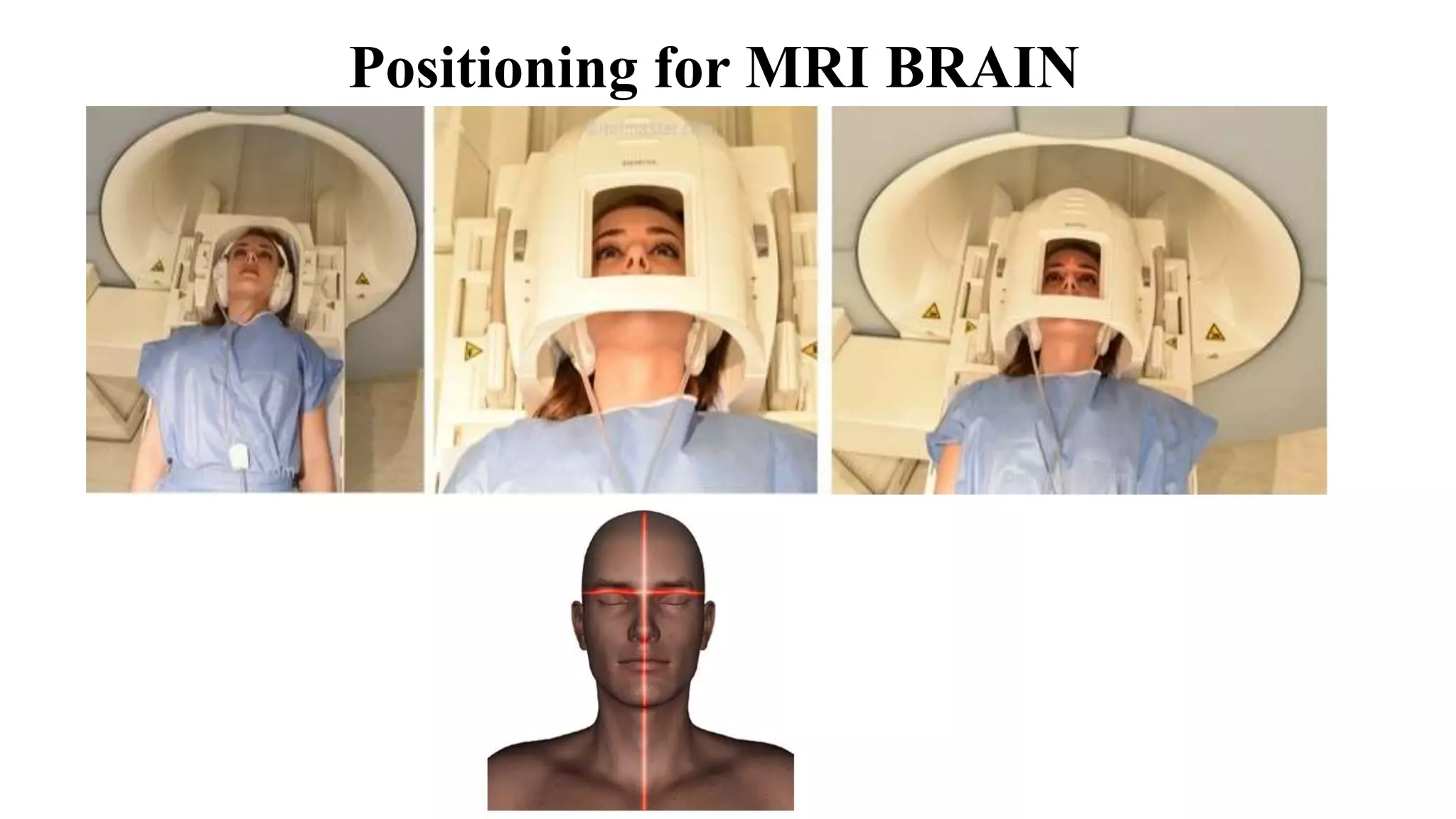 MRI PROCEDURE OF BRAIN | PPTX