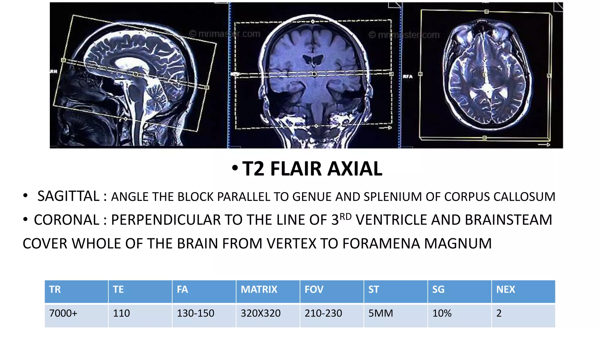 MRI PROCEDURE OF BRAIN | PPTX