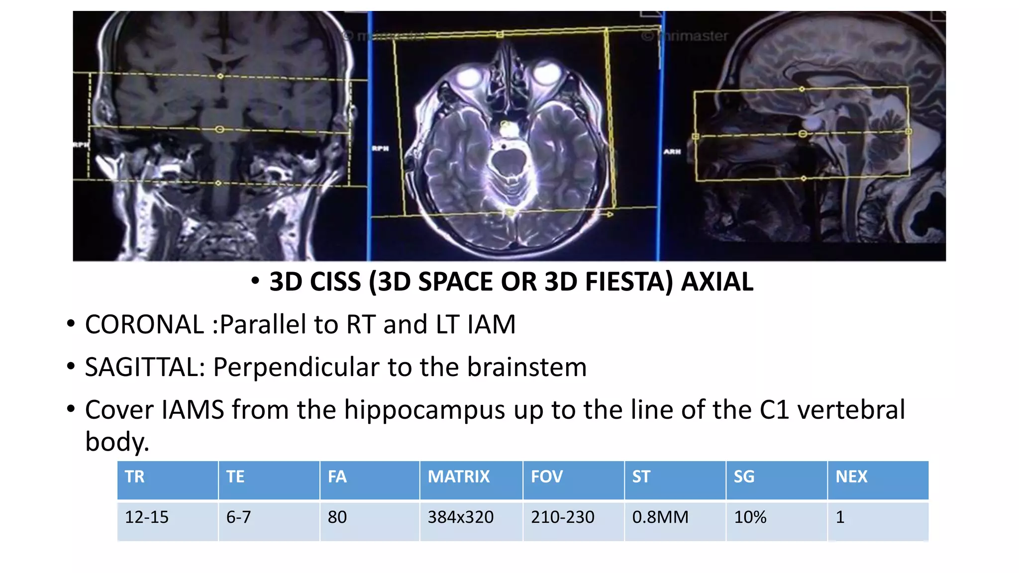 MRI PROCEDURE OF BRAIN | PPTX | Brain and Nervous System Disorders ...