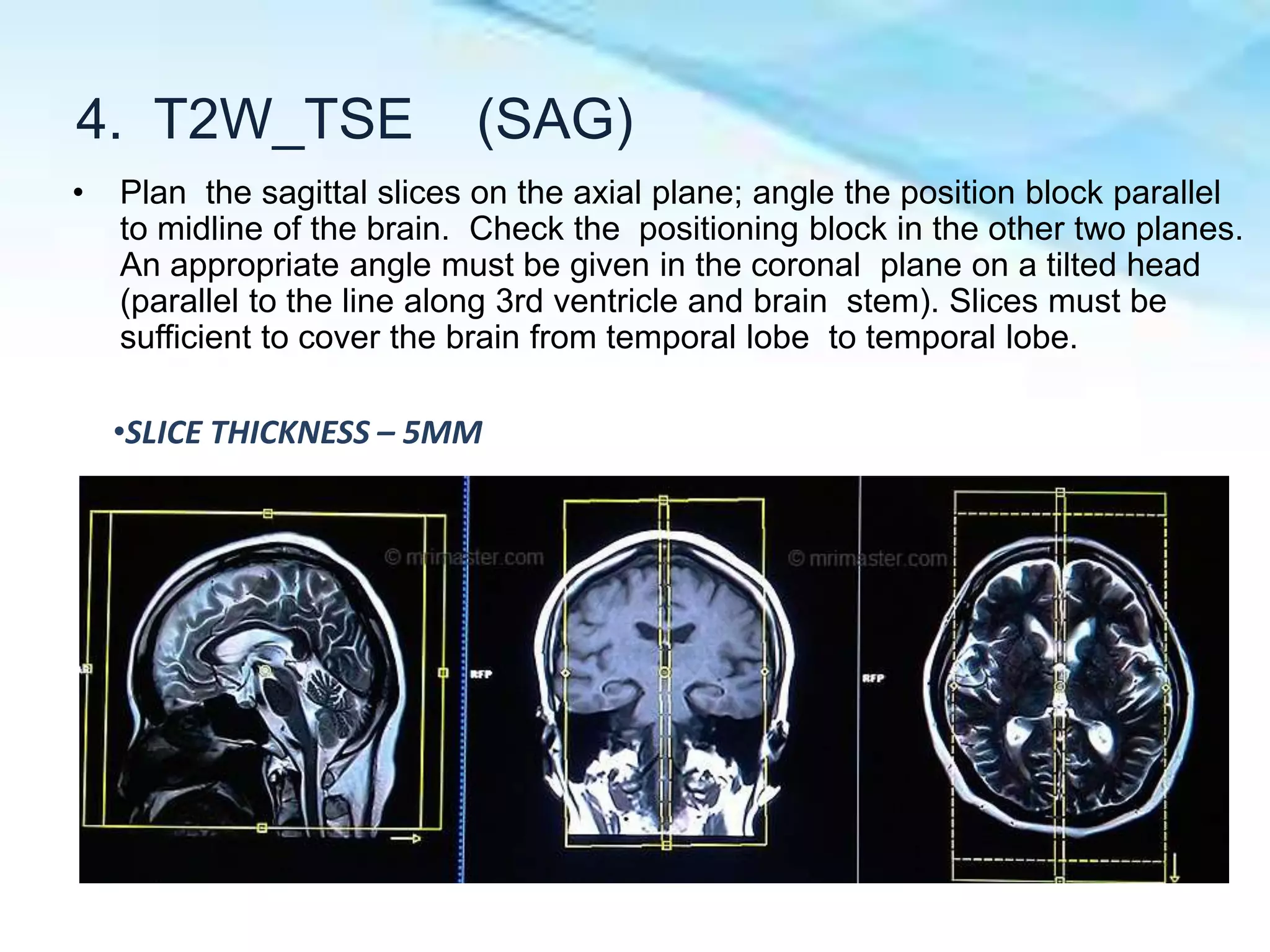 MRI BRAIN(AIIMS DELHI).pptx