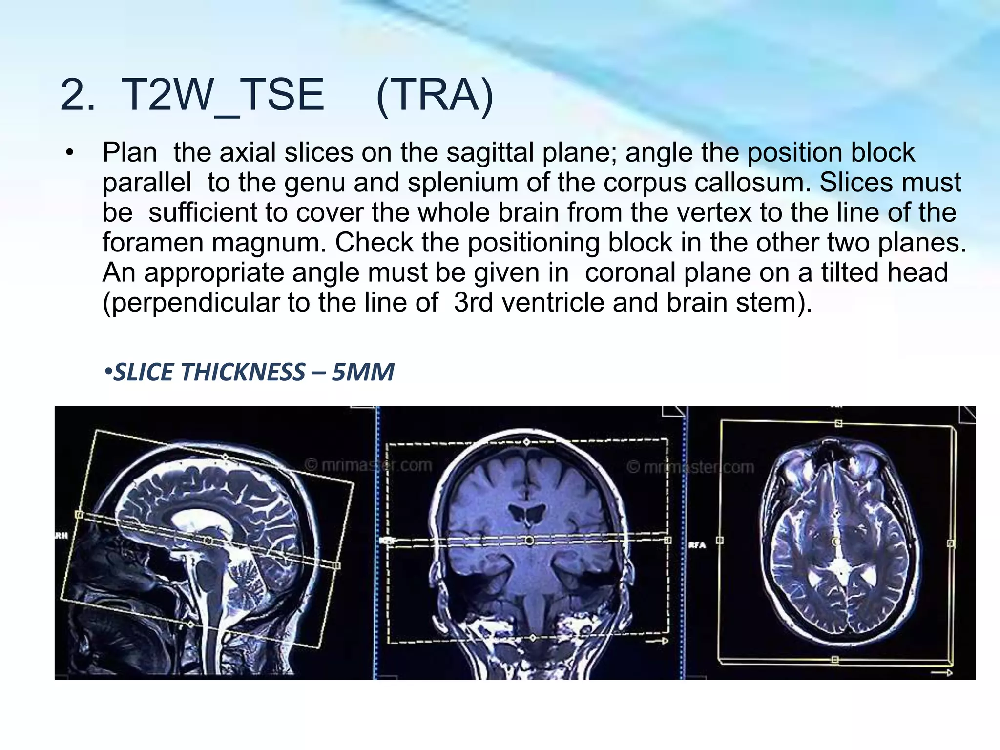 MRI BRAIN(AIIMS DELHI).pptx