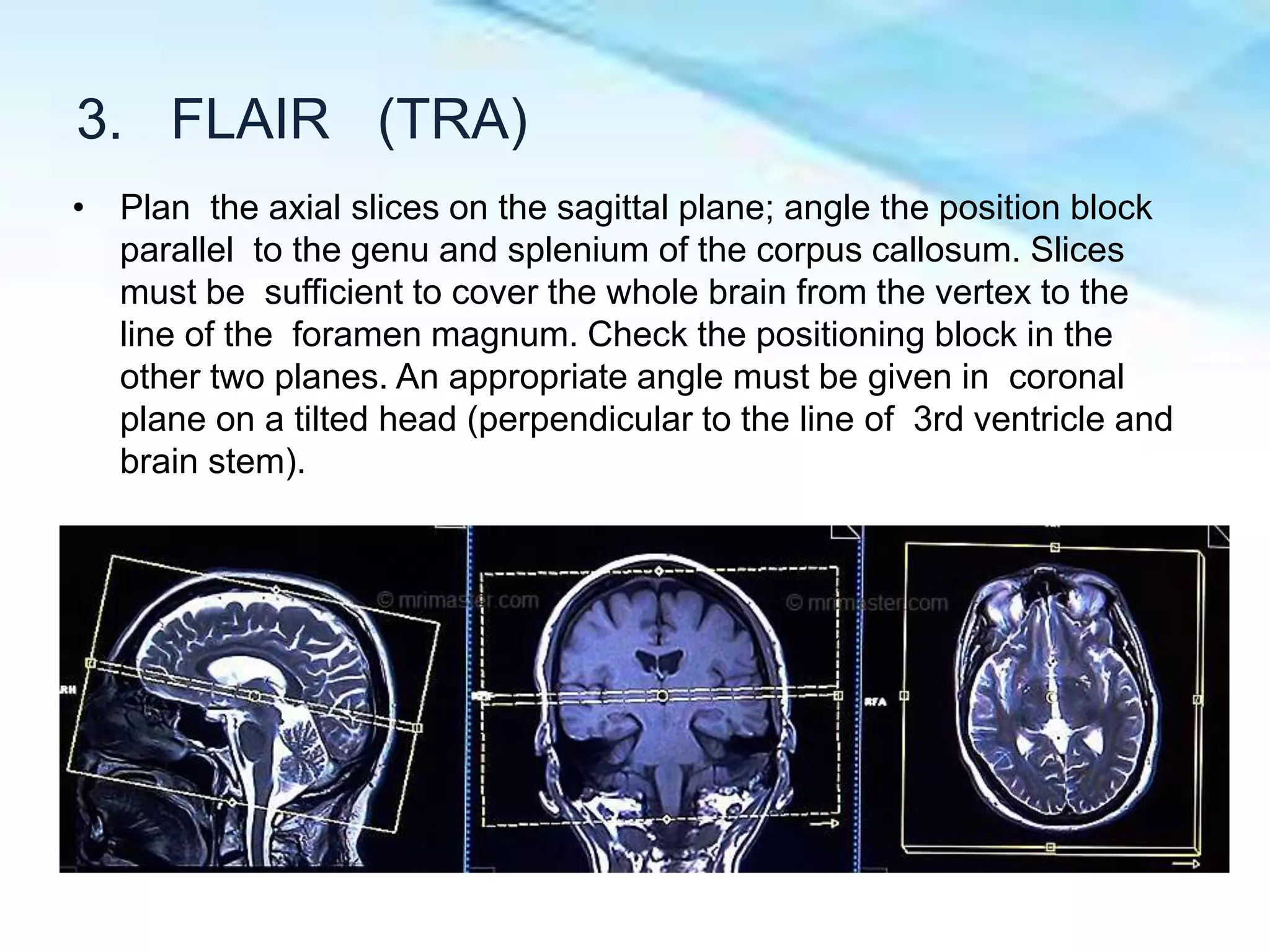 MRI BRAIN(AIIMS DELHI).pptx