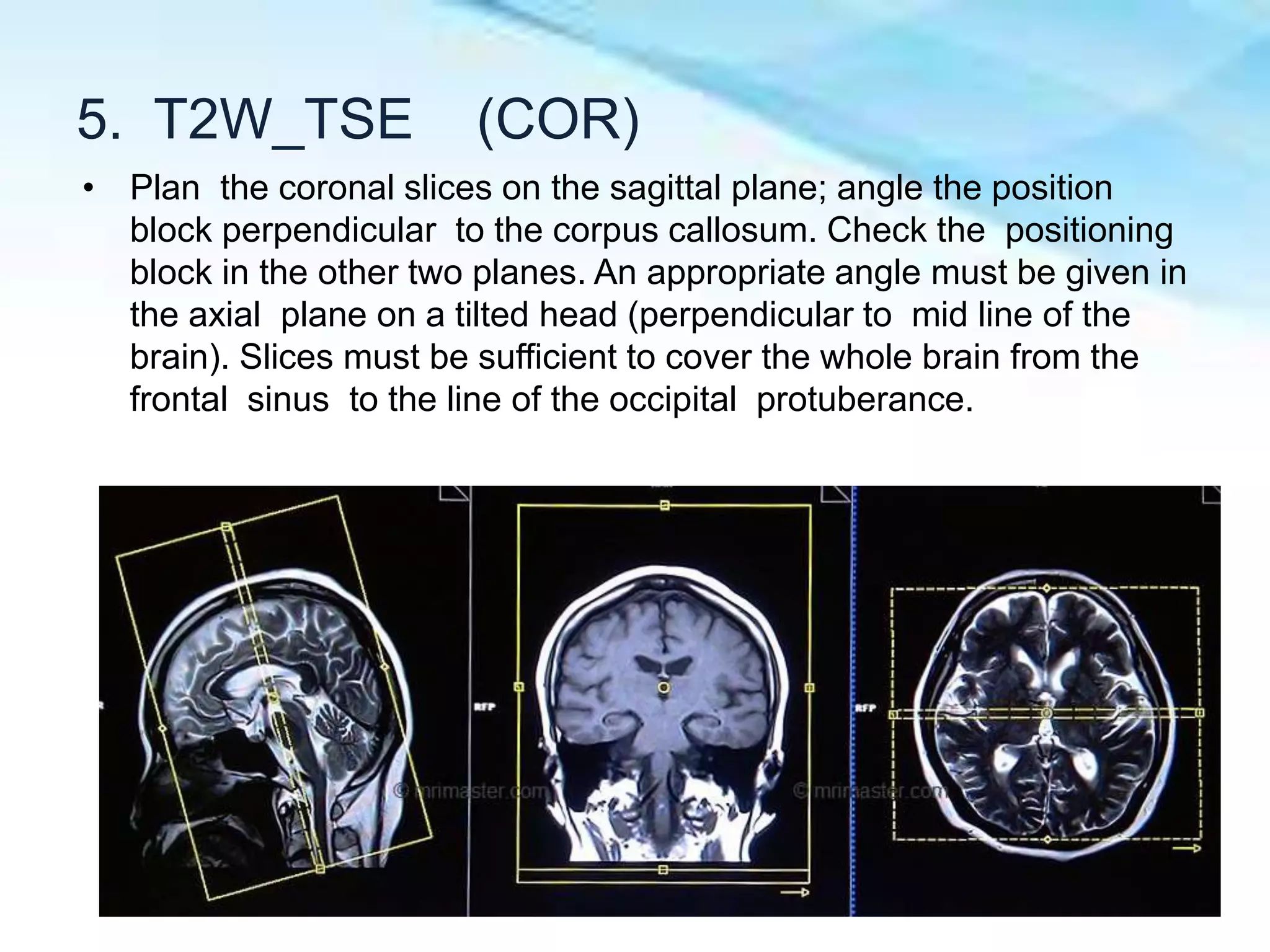MRI BRAIN(AIIMS DELHI).pptx