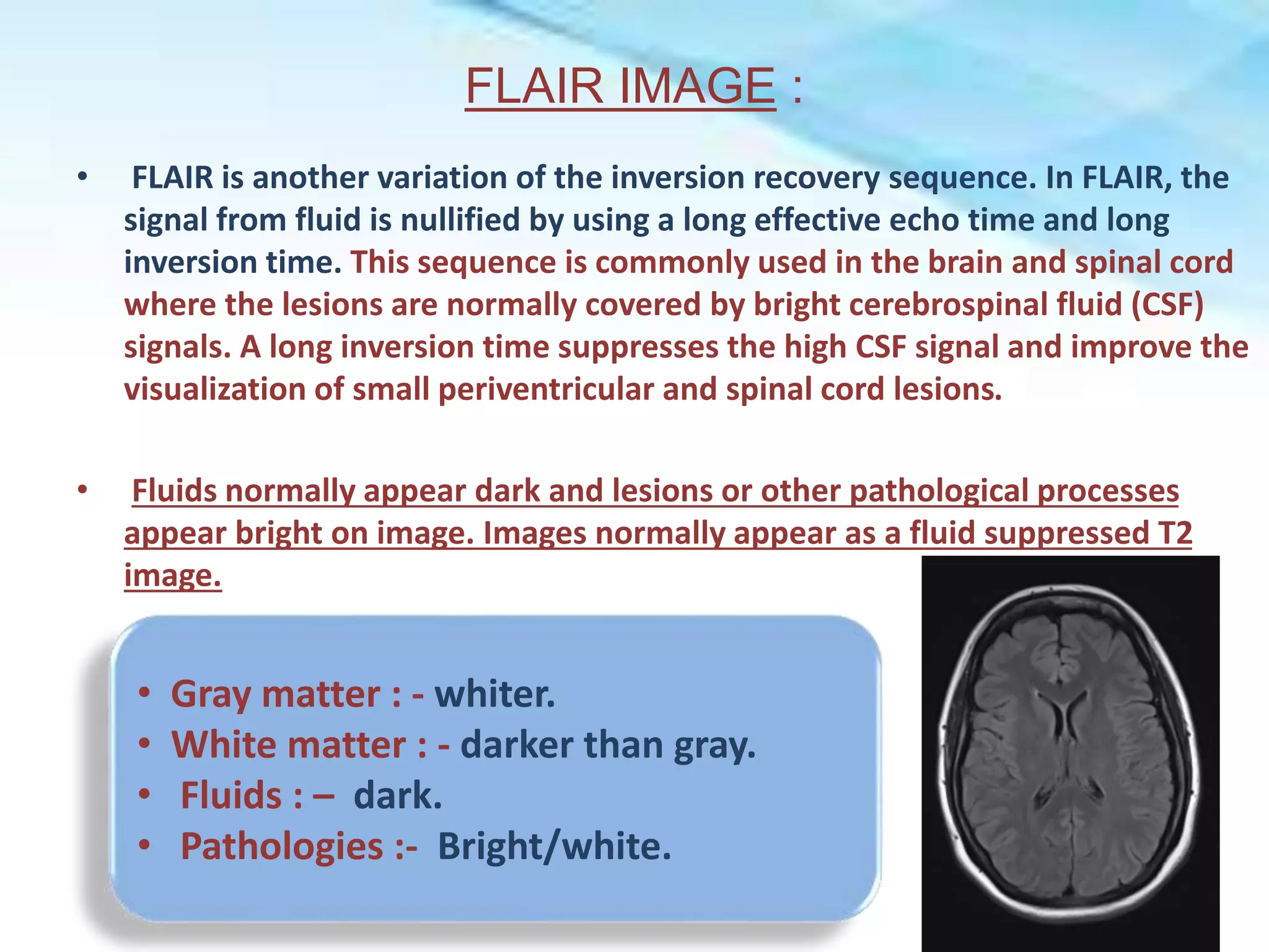 MRI BRAIN(AIIMS DELHI).pptx