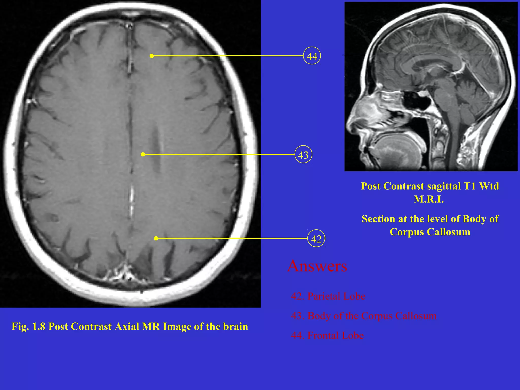 Mri brain anatomy Dr Muhammad Bin Zulfiqar | PPT