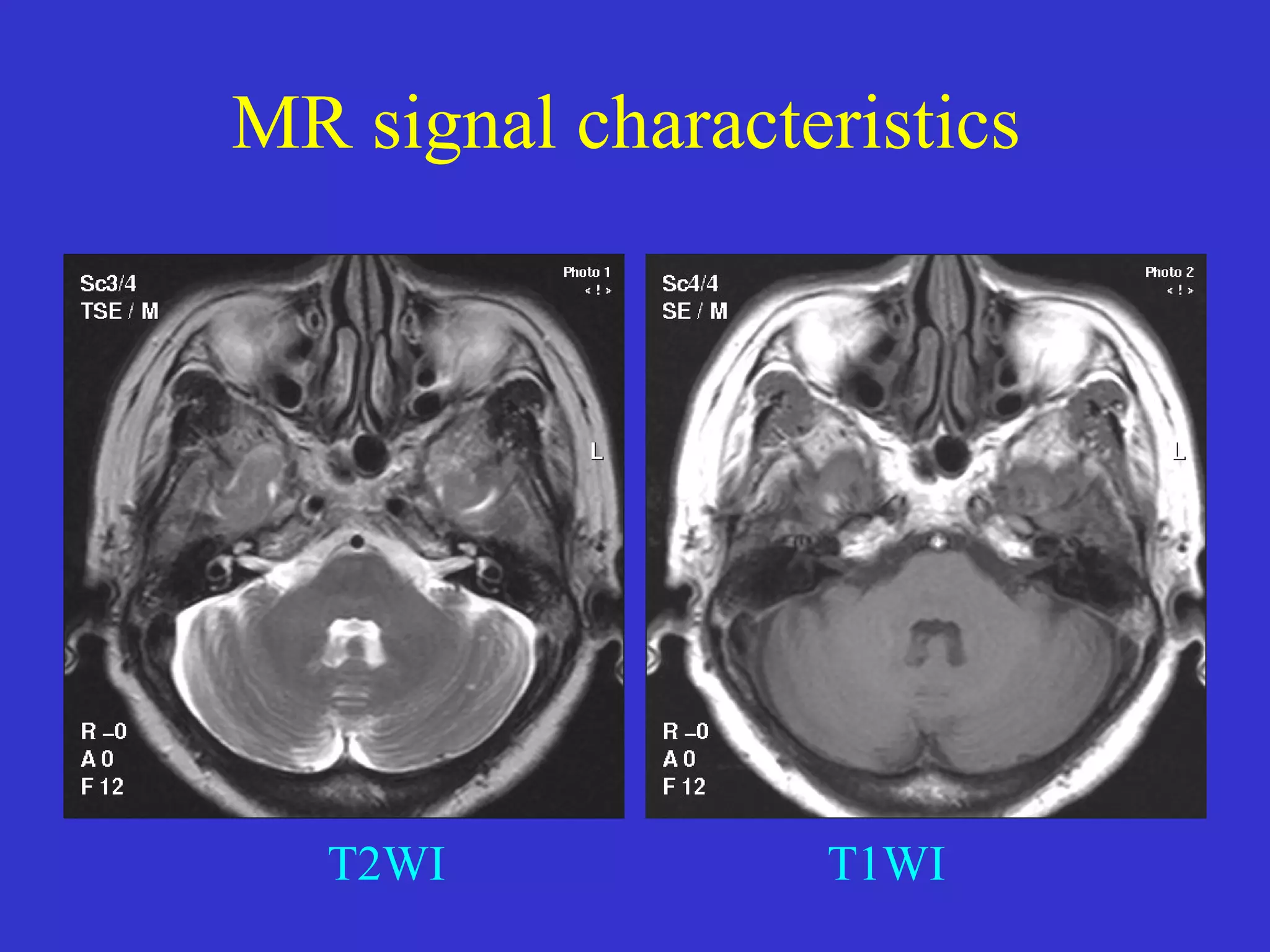 Mri brain anatomy Dr Muhammad Bin Zulfiqar | PPT
