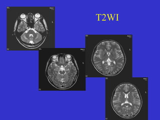 Mri brain anatomy Dr Muhammad Bin Zulfiqar | PPT