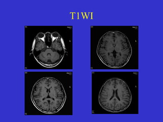 Mri brain anatomy Dr Muhammad Bin Zulfiqar | PPT