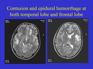 Mri brain anatomy Dr Muhammad Bin Zulfiqar | PPT