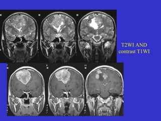 Mri brain anatomy Dr Muhammad Bin Zulfiqar | PPT