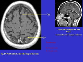 Mri Brain Anatomy