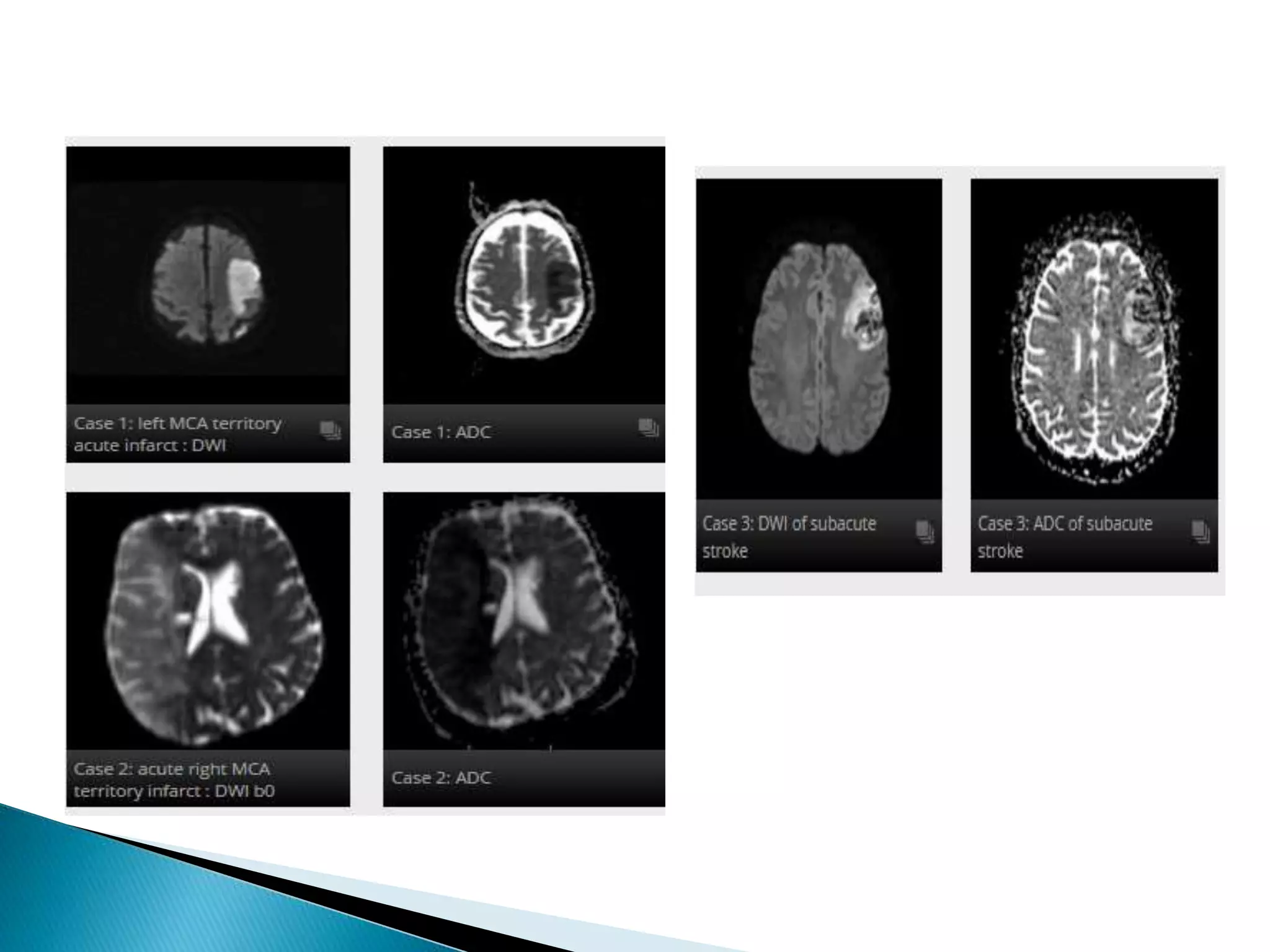 Mri brain imaging | PPTX | Brain and Nervous System Disorders | Diseases and Conditions