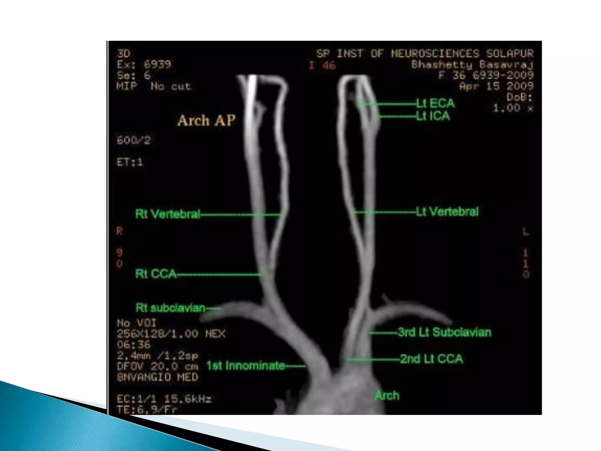 Mri brain imaging | PPTX | Brain and Nervous System Disorders | Diseases and Conditions