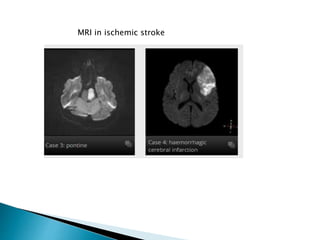 Mri brain imaging | PPTX