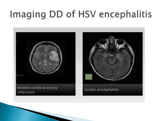 Mri brain imaging | PPT
