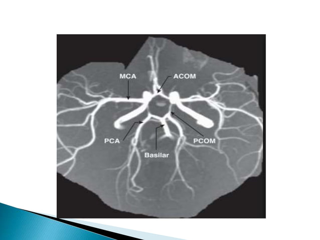 Mri brain imaging | PPTX