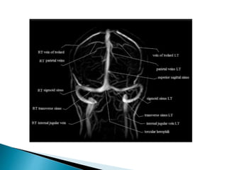 Mri brain imaging | PPT