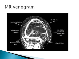 Mri brain imaging | PPT
