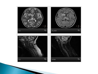 Mri brain imaging | PPT