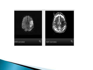Mri brain imaging | PPT