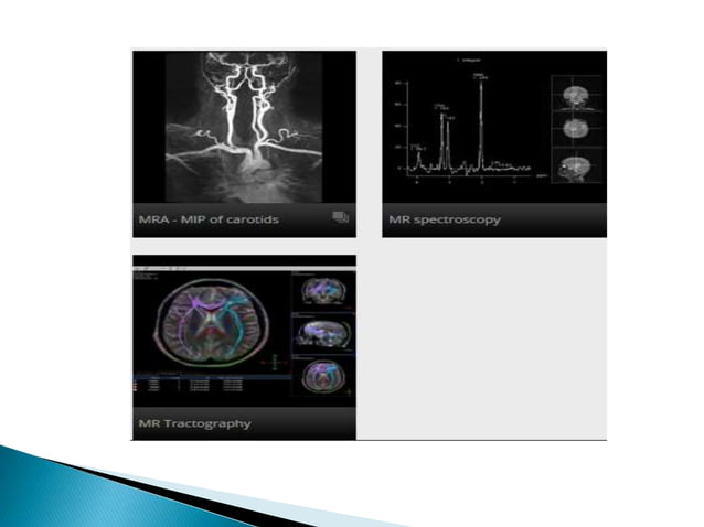 Mri brain imaging | PPTX