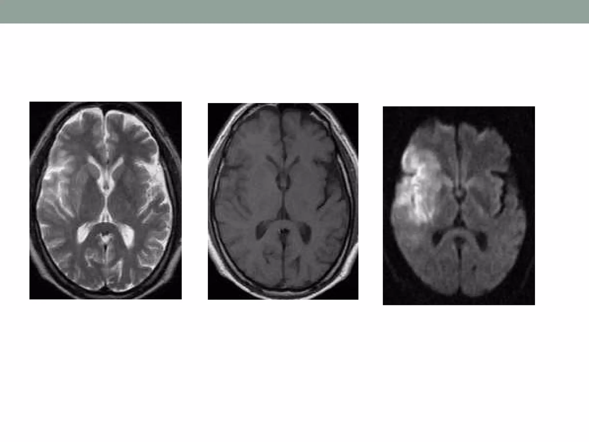 MRI brain; Basics and Radiological Anatomy | PPT | Physics | Science