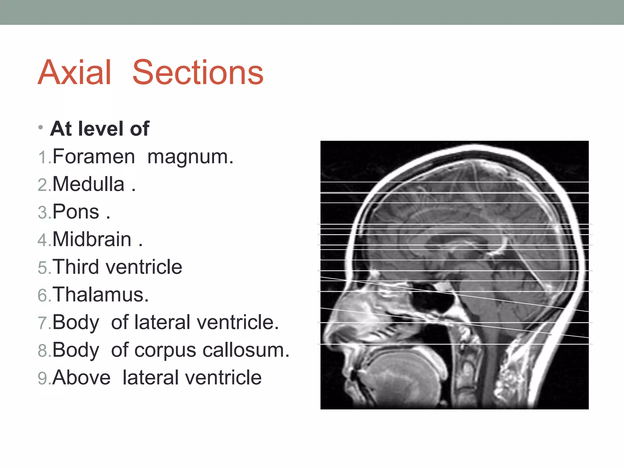 MRI brain; Basics and Radiological Anatomy | PPT