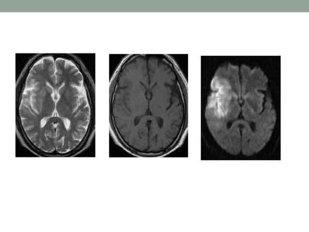 MRI brain; Basics and Radiological Anatomy | PPT | Physics | Science