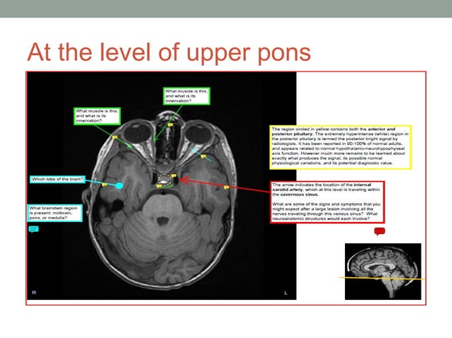 MRI brain; Basics and Radiological Anatomy | PPT | Physics | Science
