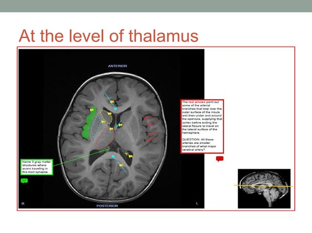 MRI brain; Basics and Radiological Anatomy | PPT | Physics | Science
