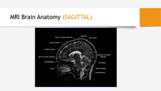 Comprehensive MRI Brain Imaging: Techniques, Indications, and Safety | PDF