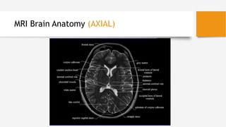 Comprehensive MRI Brain Imaging: Techniques, Indications, and Safety | PDF