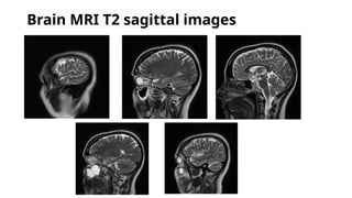 MRI BRAIN PROTOCOL- PRESENTED BY SHUBHASHIS MONDAL | PPTX