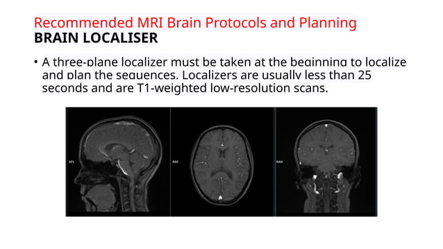 MRI BRAIN PROTOCOL- PRESENTED BY SHUBHASHIS MONDAL | PPT