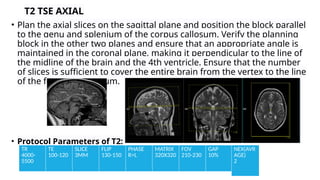 MRI BRAIN PROTOCOL- PRESENTED BY SHUBHASHIS MONDAL | PPTX