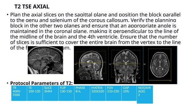 MRI BRAIN PROTOCOL- PRESENTED BY SHUBHASHIS MONDAL | PPT