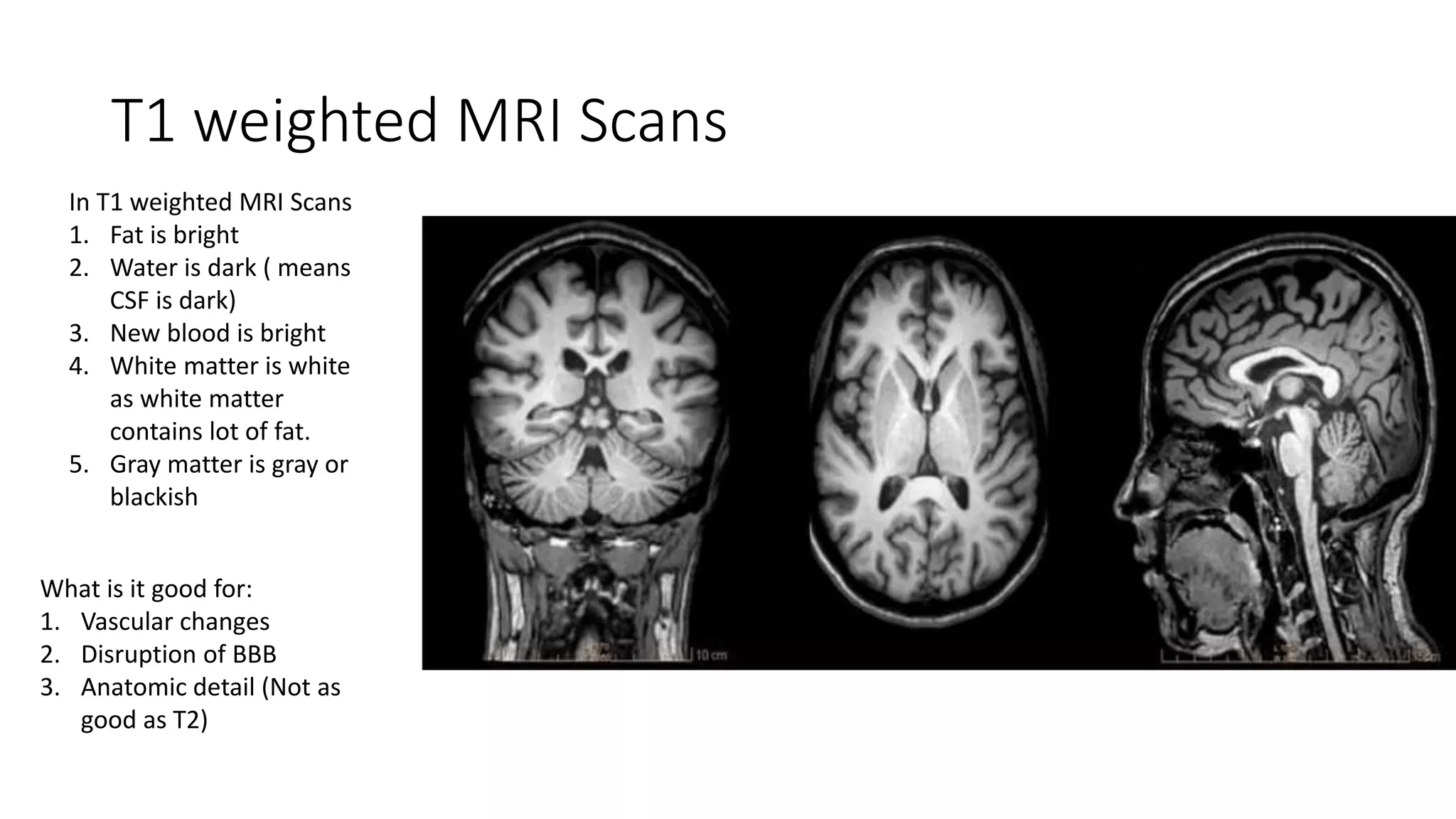 Mri brain sequences | PPTX