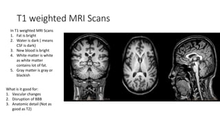 Mri brain sequences | PPTX