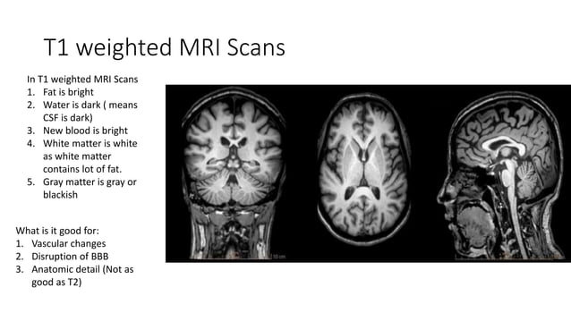 Mri brain sequences | PPTX | Chemistry | Science