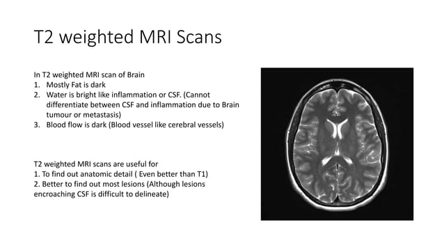 Mri brain sequences | PPTX | Chemistry | Science