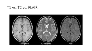 Mri brain sequences | PPTX
