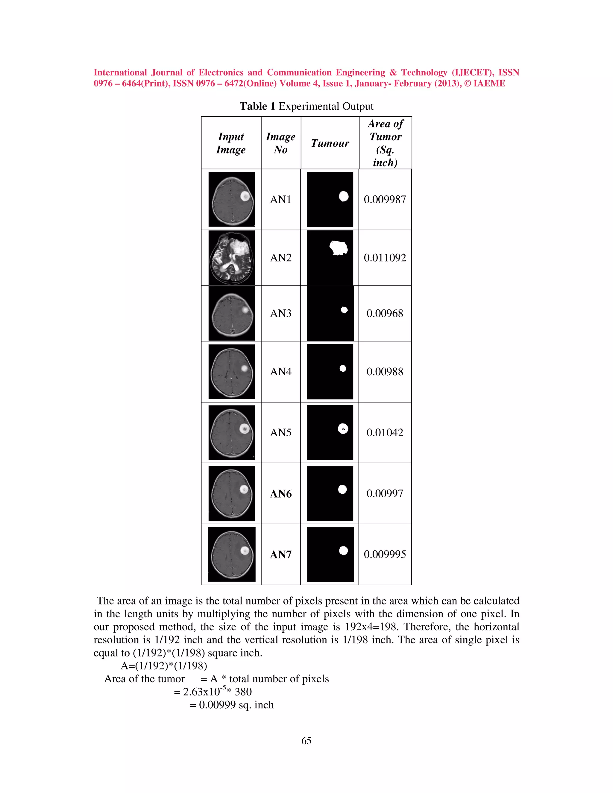 Mri Brain Tumour Detection By Histogram And Segmentation Pdf 